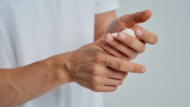 Hand– oder Finger-Prellung | Prellung