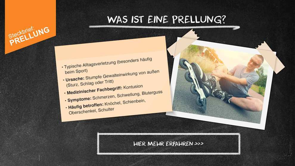 Mittel bei Prellungen | Prellung